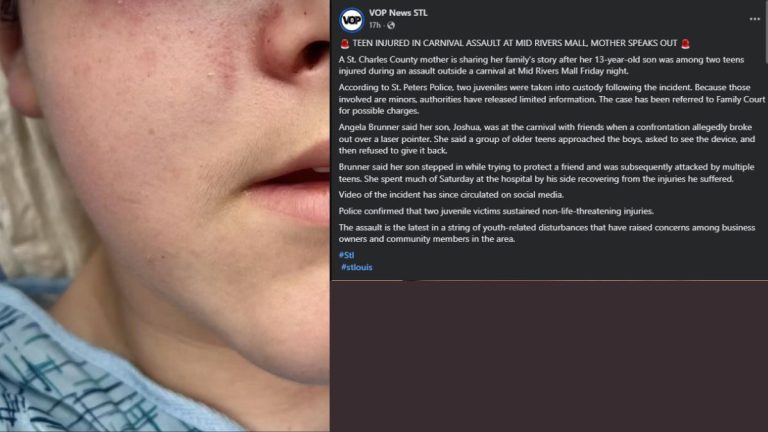 Teen Injured at Mid Rivers Mall Carnival After Laser Pointer Dispute ...